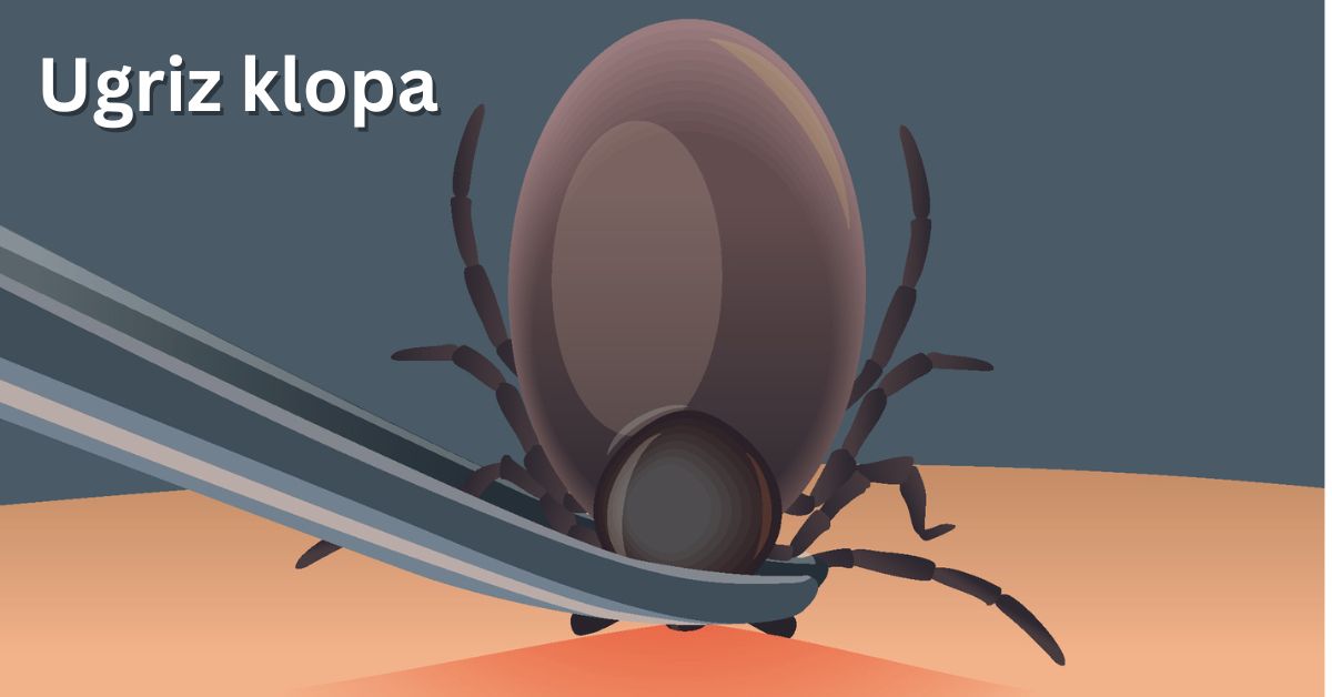 Ugriz klopa in bolezni, povezane z ugrizom klopa - Triglav Zdravje